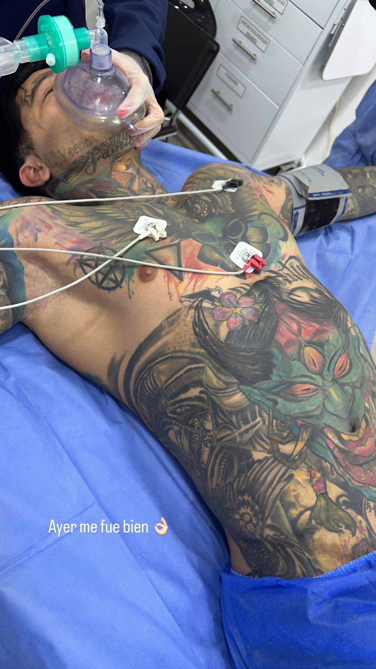 Yeferson Cossio Utilizó Anestesia General Para Nuevo Tatuaje Y Es 0558