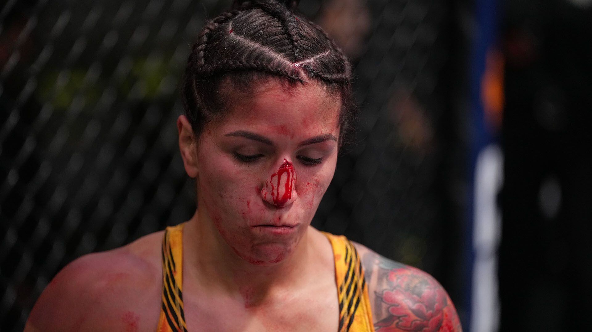 Їй не вистачає двох зубів і її фото стало вірусним після матчу Ufc «Я найсимпатичніша беззуба